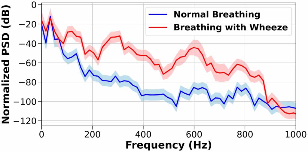 MEMS piezoelectric resonant microphone array for lung sound ...