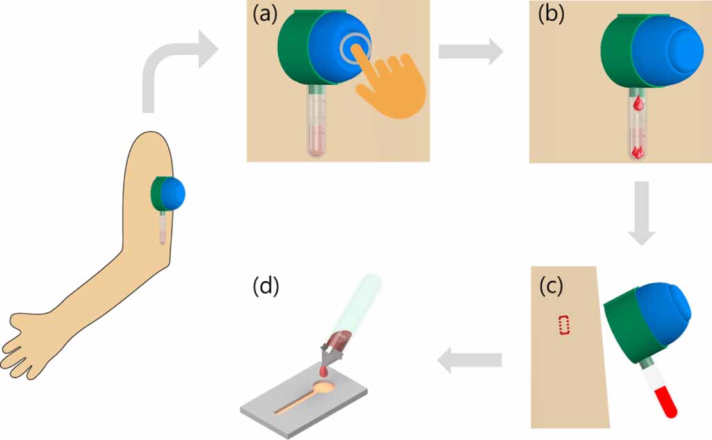 Development of microneedle based blood extraction device - IOPscience