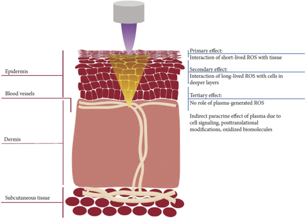 Foundations of plasmas for medical applications - IOPscience