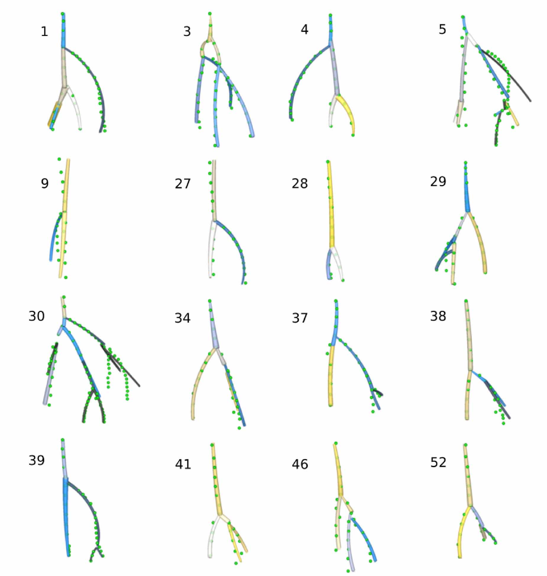 Imaging and reconstruction of positive streamer discharge tree ...