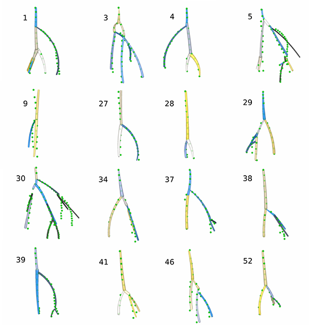 Imaging and reconstruction of positive streamer discharge tree ...