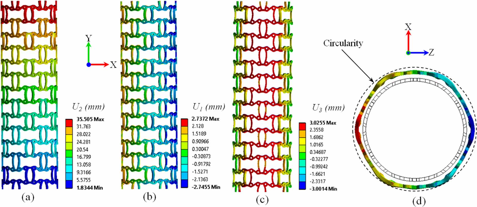 3D printed auxetic stents with re-entrant and chiral topologies ...