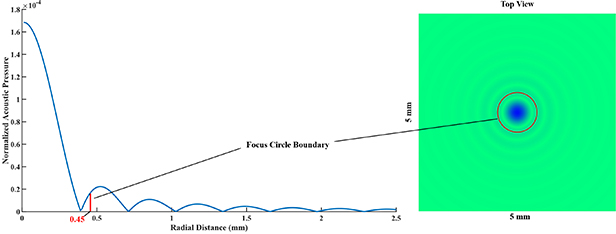 Insulated rail joint (IRJ) contact characterisation-an ultrasonic ...