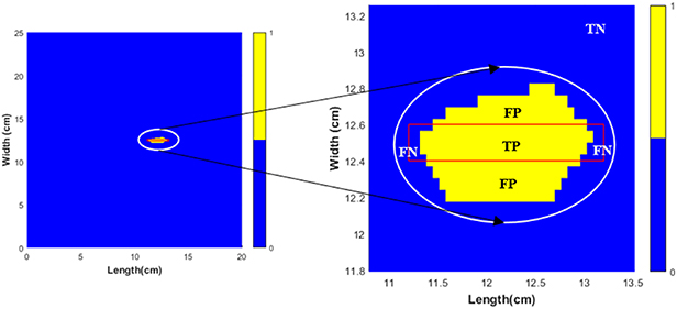 A global-local damage localization and quantification approach in composite structures using ...