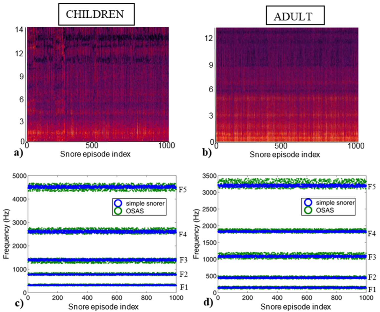 Acoustics of snoring and automatic snore sound detection in children - IOPscience