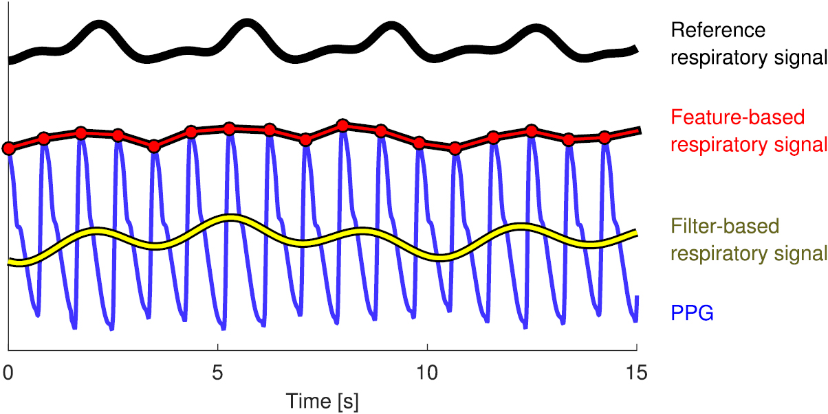 Extraction of respiratory signals from the electrocardiogram and ...