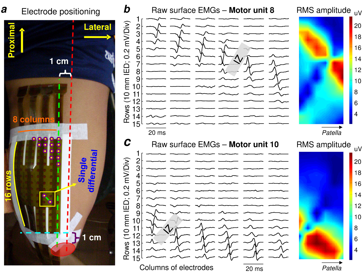 Surface EMG and muscle fatigue: multi-channel approaches to the study ...