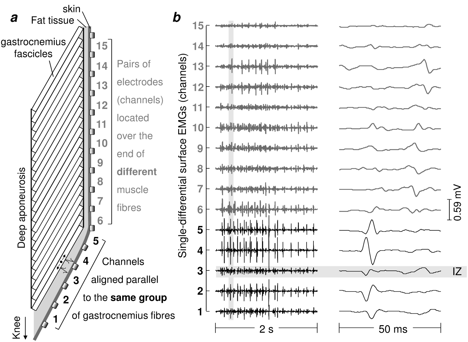 Surface EMG and muscle fatigue: multi-channel approaches to the study ...