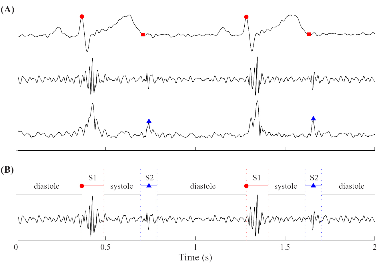 Performance of an open-source heart sound segmentation algorithm on ...