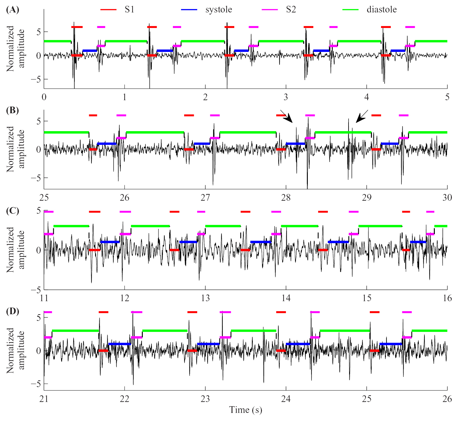 Performance of an open-source heart sound segmentation algorithm on ...