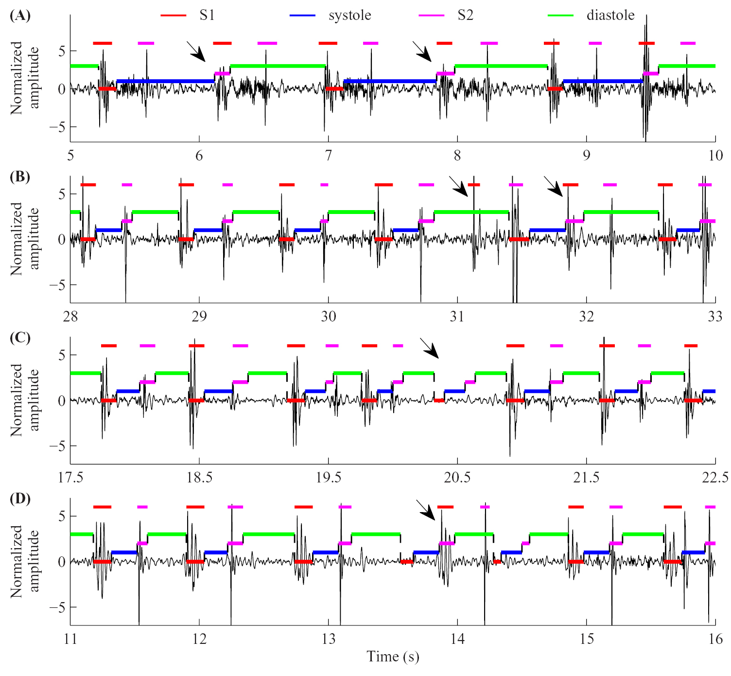Performance of an open-source heart sound segmentation algorithm on ...