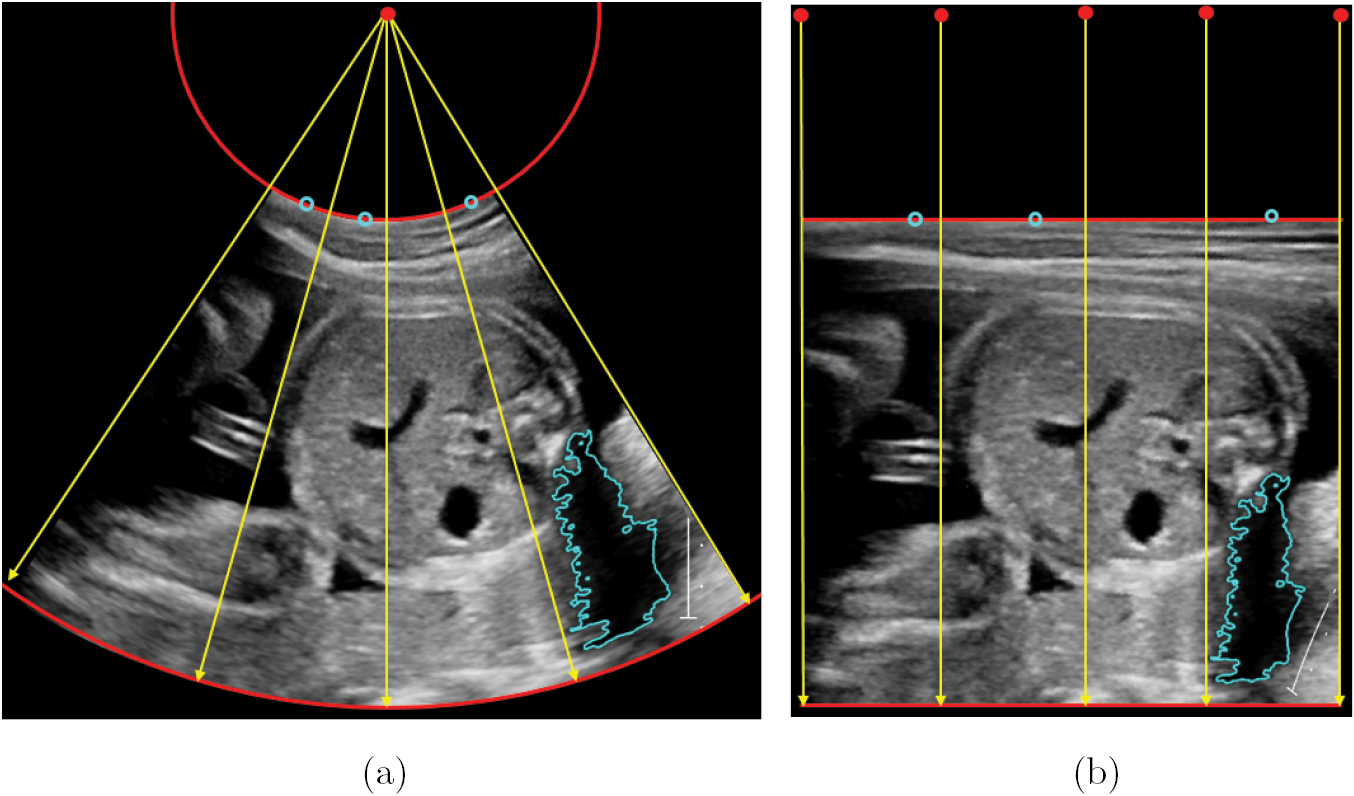 Machine-learning-based automatic identification of fetal abdominal ...