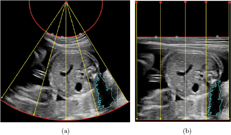 Machine-learning-based automatic identification of fetal abdominal ...
