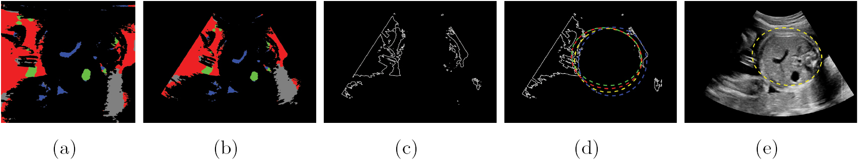 Machine-learning-based automatic identification of fetal abdominal ...