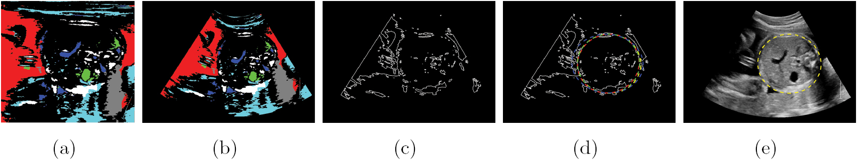 Machine-learning-based automatic identification of fetal abdominal ...