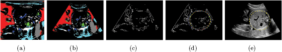 Machine-learning-based automatic identification of fetal abdominal ...