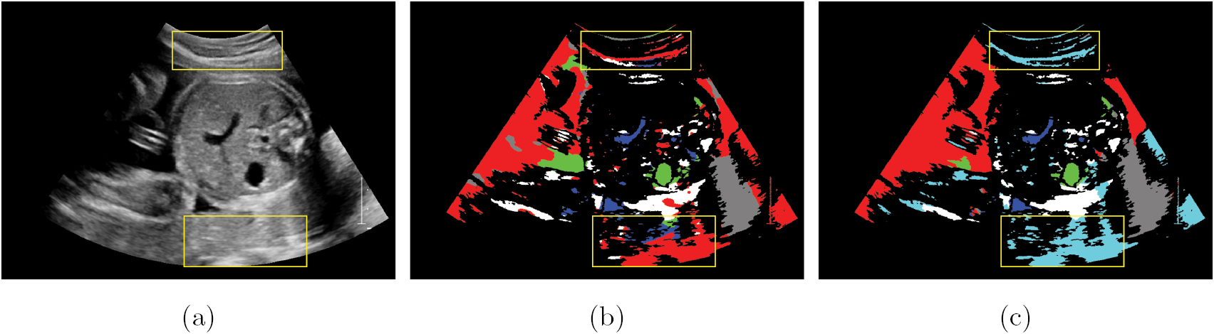 Machine-learning-based automatic identification of fetal abdominal ...