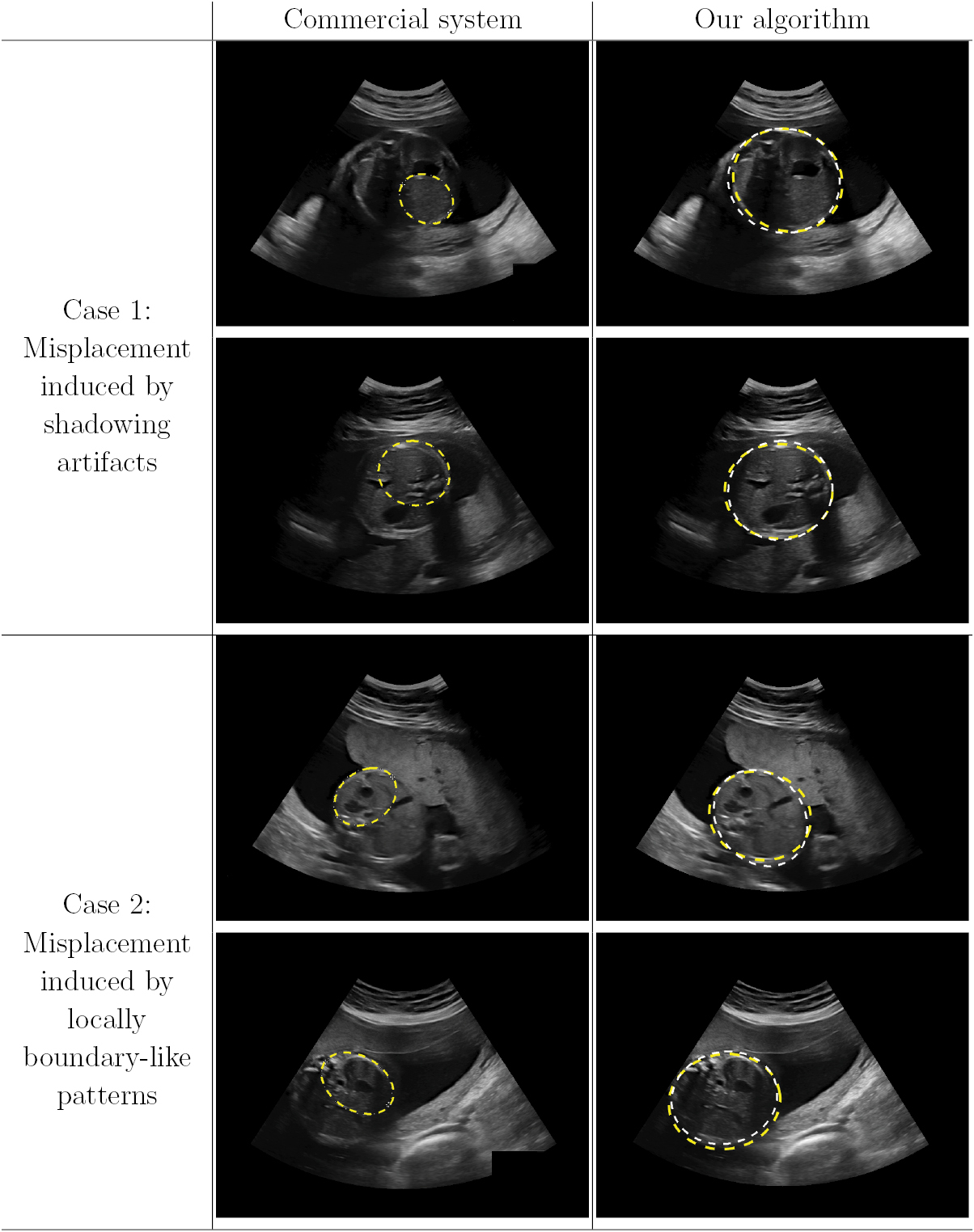 Machine-learning-based automatic identification of fetal abdominal ...