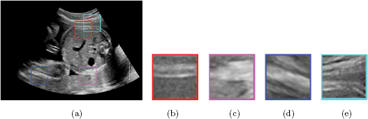 Machine-learning-based automatic identification of fetal abdominal ...