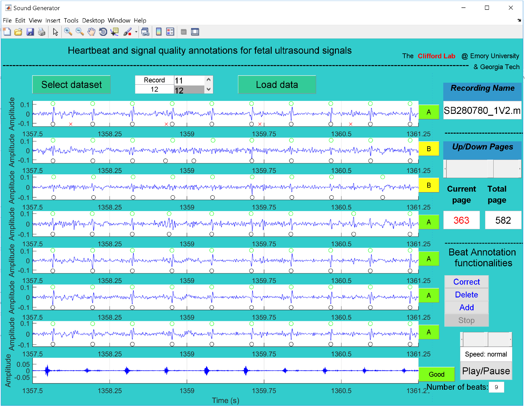 An open source autocorrelation-based method for fetal heart rate ...