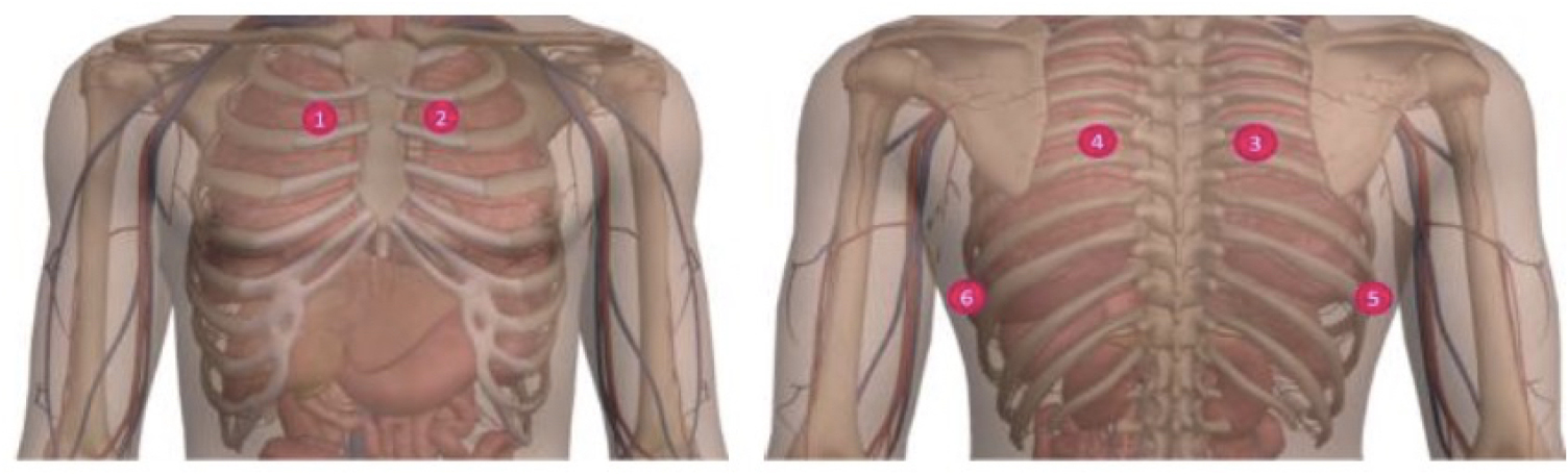 An open access database for the evaluation of respiratory sound classification algorithms ...