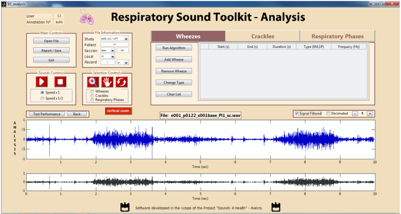 An open access database for the evaluation of respiratory sound classification algorithms ...