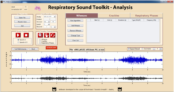 An open access database for the evaluation of respiratory sound classification algorithms ...