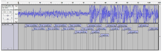 An open access database for the evaluation of respiratory sound ...