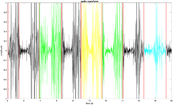 An open access database for the evaluation of respiratory sound classification algorithms ...