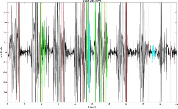 An open access database for the evaluation of respiratory sound classification algorithms ...