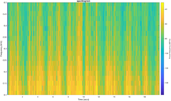 An open access database for the evaluation of respiratory sound classification algorithms ...