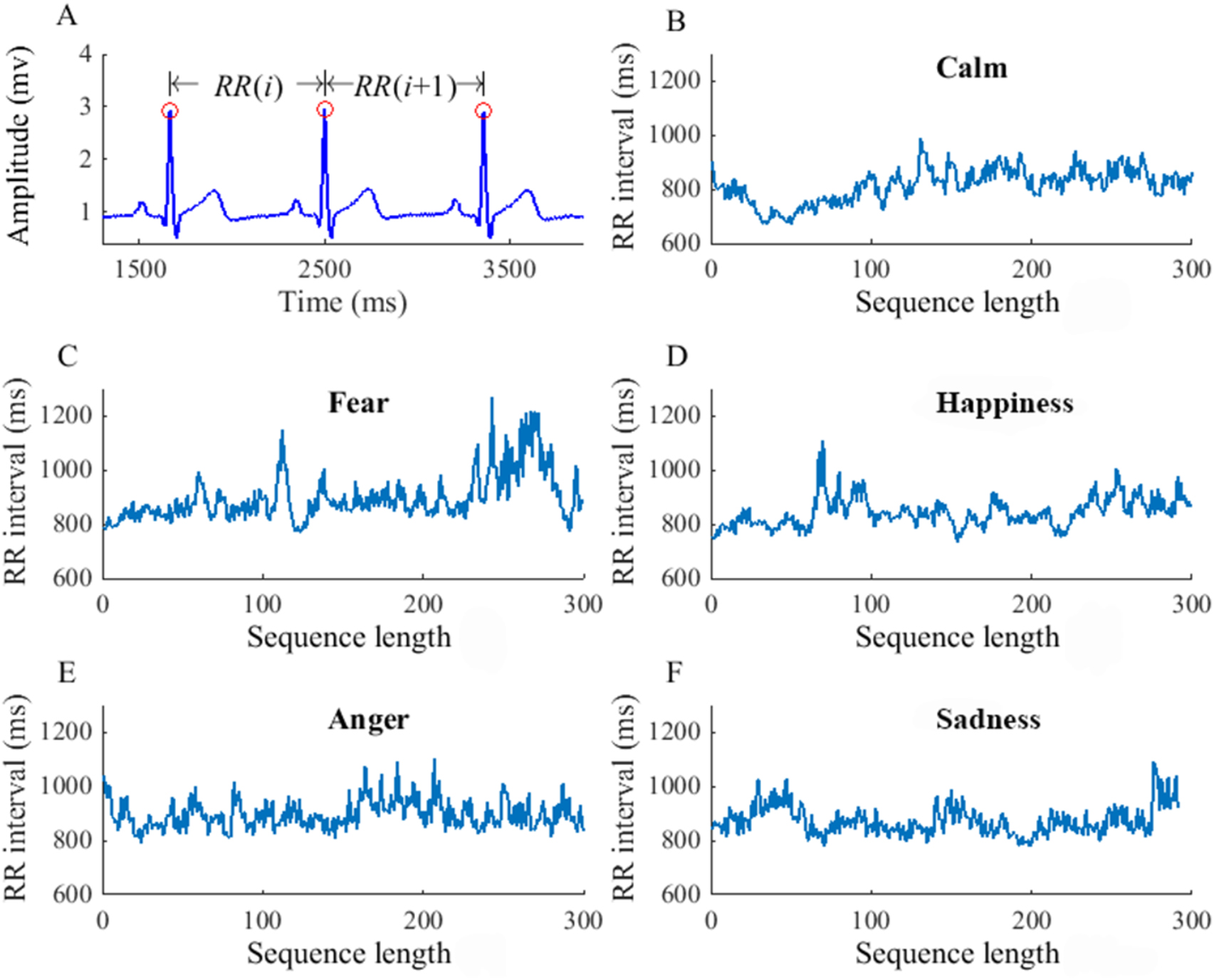 Heart rate variability monitoring for emotion and disorders of emotion ...