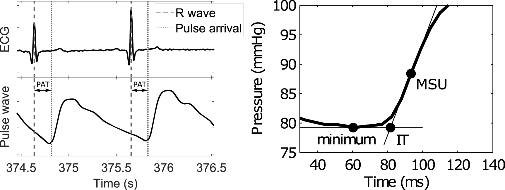 Non-invasive quantification of the effect of device-guided slow ...