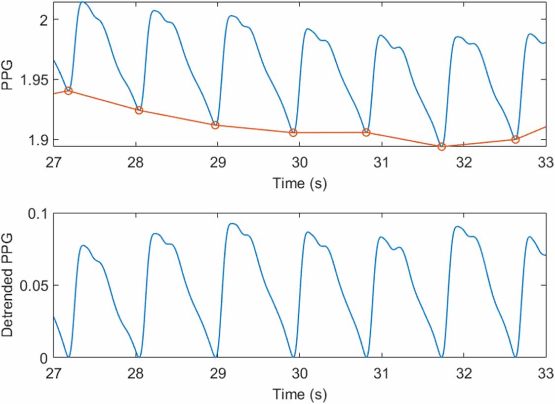 Robust blood pressure estimation from finger photoplethysmography using ...