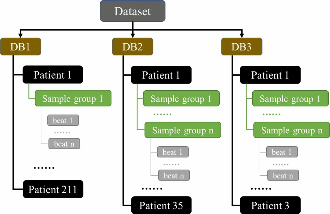 Localization of origins of premature ventricular contraction in the ...
