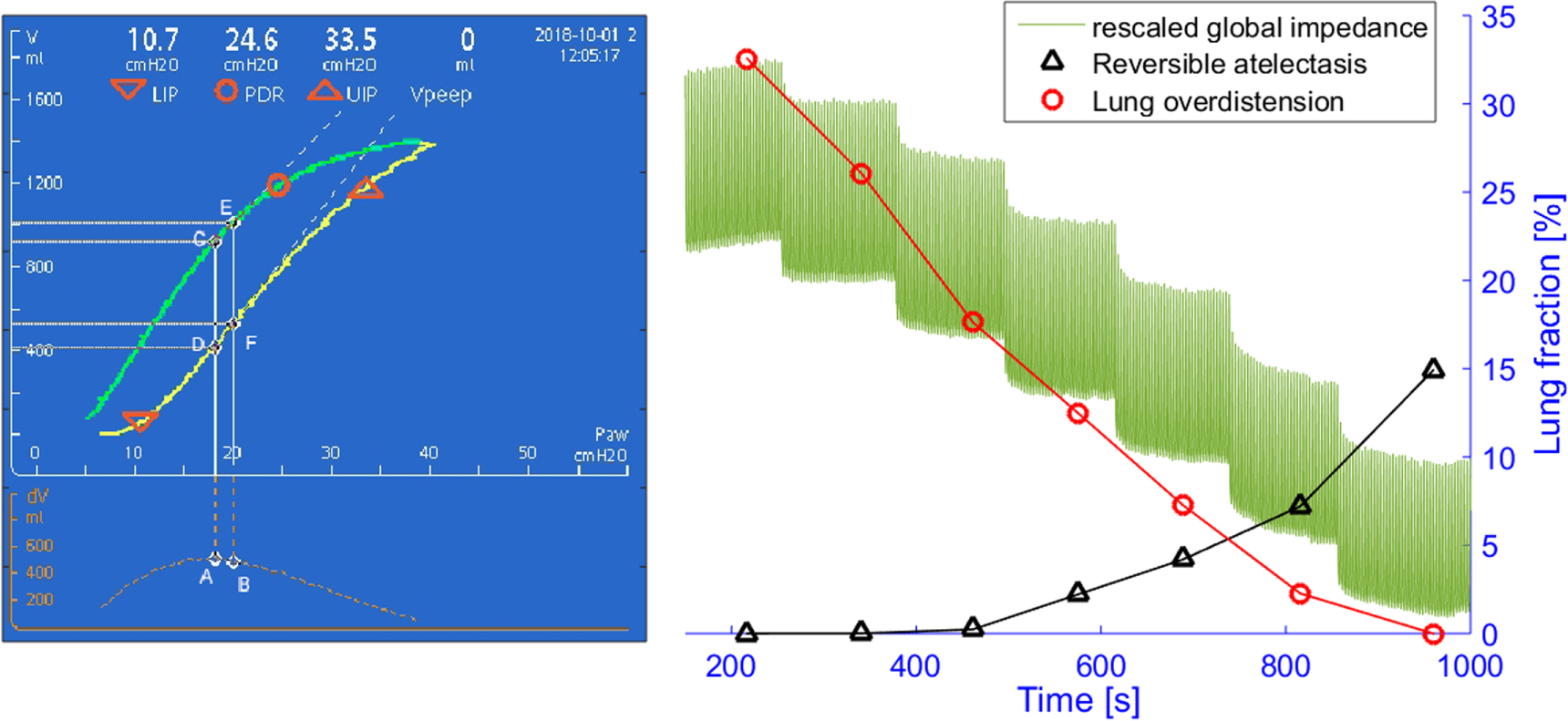 Positive end-expiratory pressure titration with electrical impedance ...