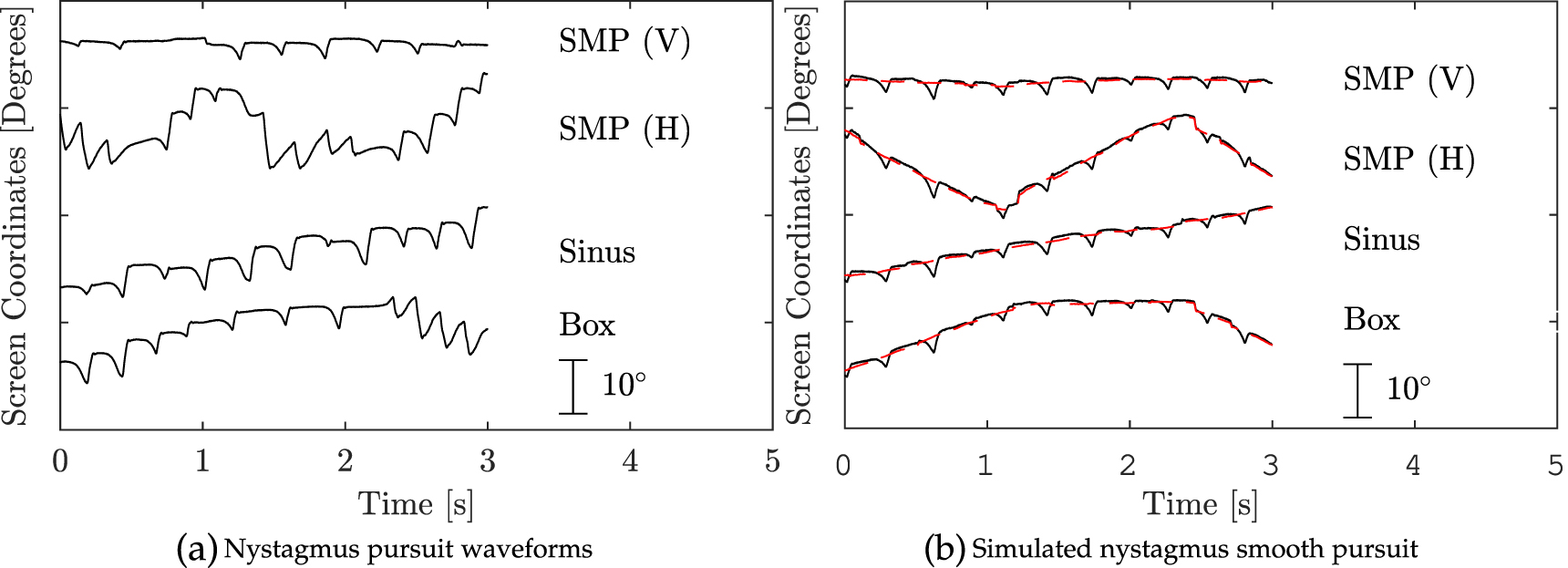 Waveform characterisation and comparison of nystagmus eye-tracking ...