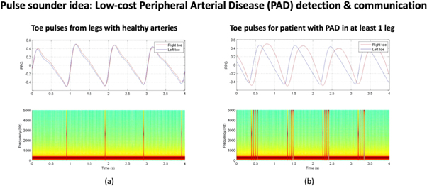 Photoplethysmography (PPG): state-of-the-art methods and applications ...