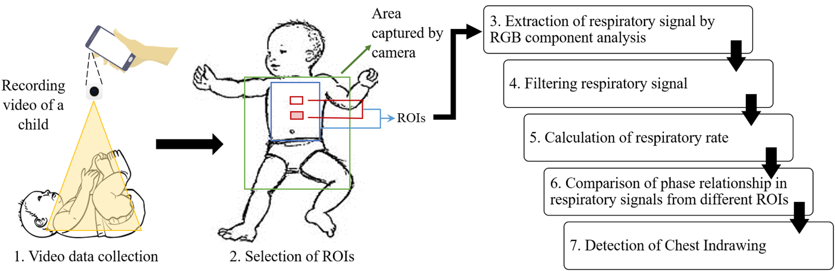 Video based non-contact monitoring of respiratory rate and chest ...