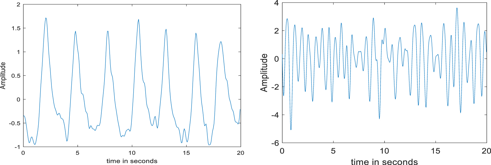 Video based non-contact monitoring of respiratory rate and chest ...