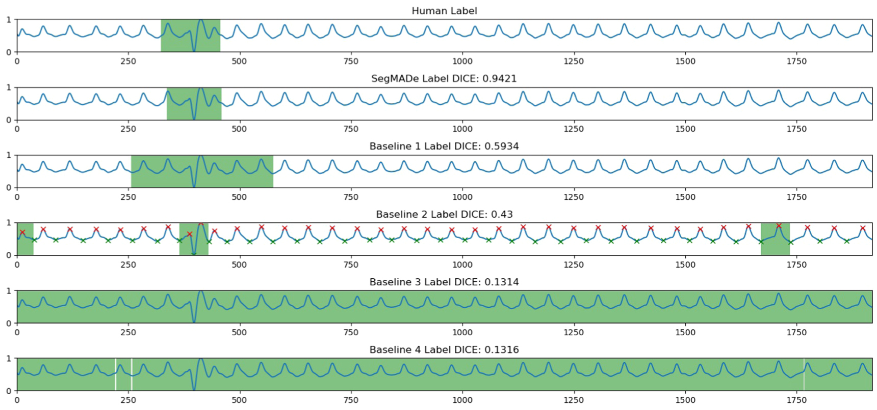 A supervised machine learning semantic segmentation approach for detecting artifacts in ...