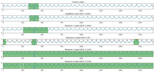 A supervised machine learning semantic segmentation approach for detecting artifacts in ...
