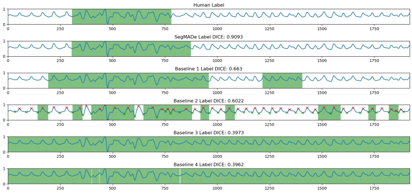 A supervised machine learning semantic segmentation approach for detecting artifacts in ...