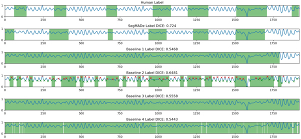 A supervised machine learning semantic segmentation approach for detecting artifacts in ...