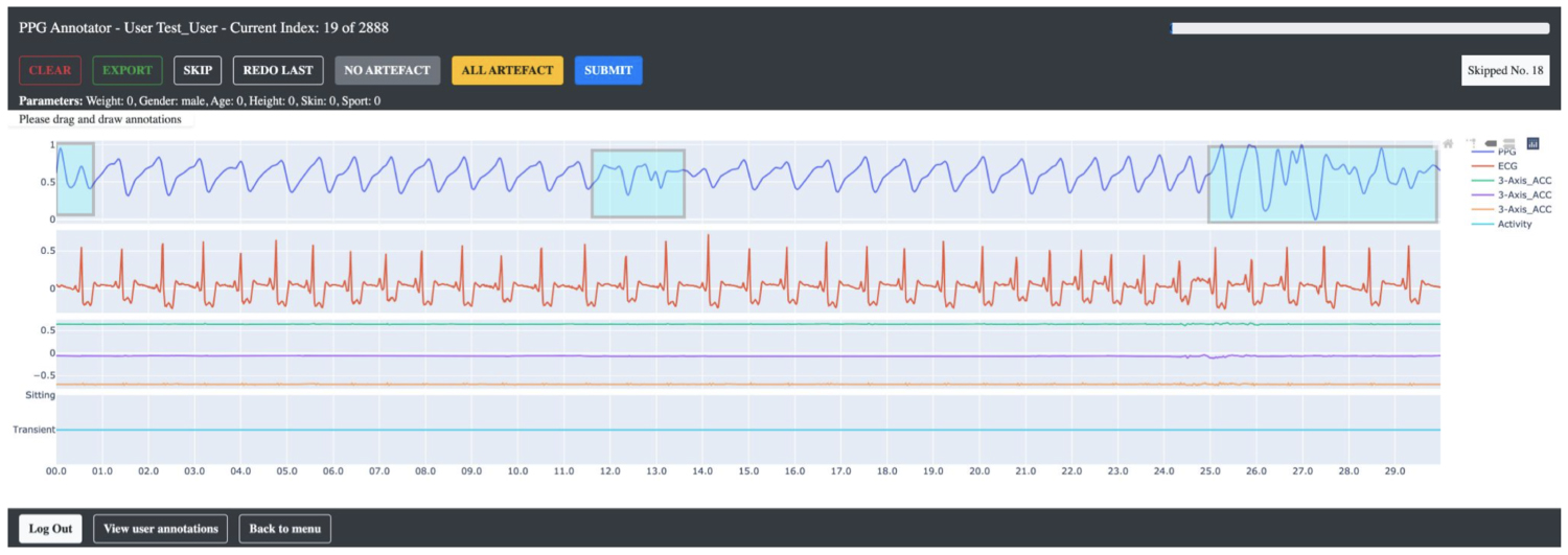 A supervised machine learning semantic segmentation approach for detecting artifacts in ...