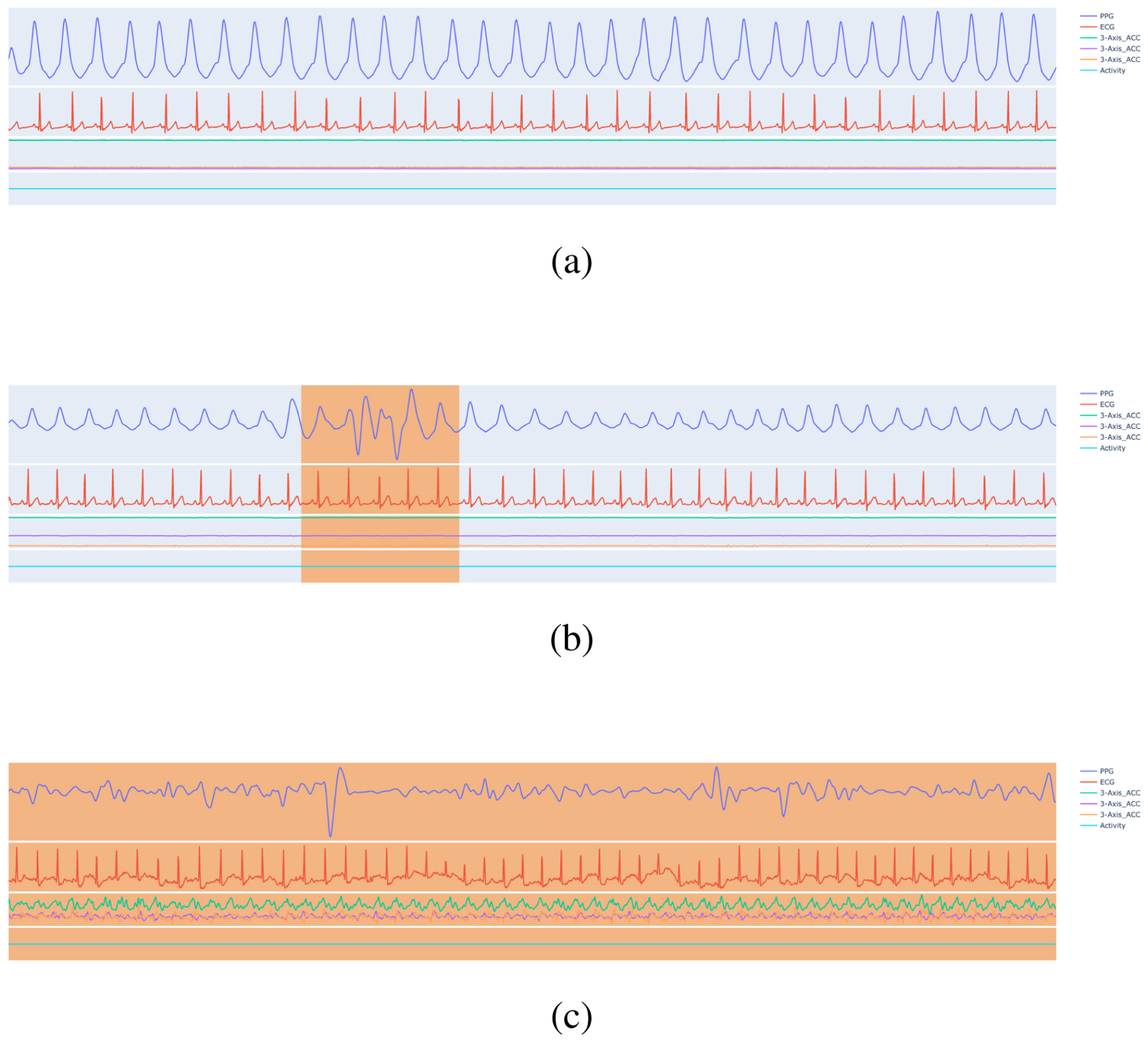 A supervised machine learning semantic segmentation approach for detecting artifacts in ...
