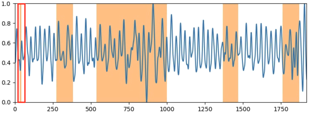 A supervised machine learning semantic segmentation approach for detecting artifacts in ...