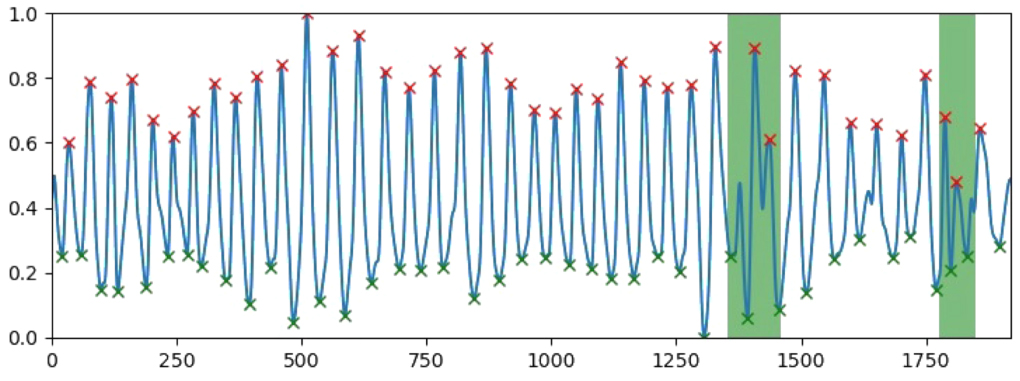 A supervised machine learning semantic segmentation approach for detecting artifacts in ...