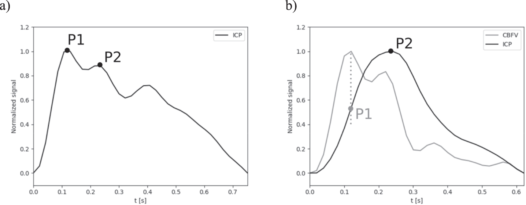 Analysis of relative changes in pulse shapes of intracranial pressure ...