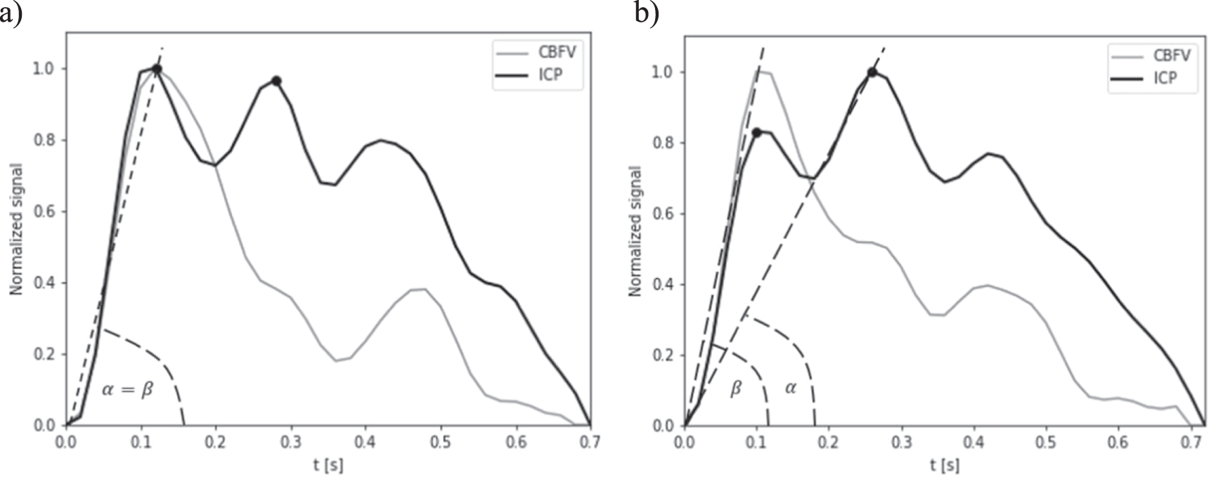 Analysis of relative changes in pulse shapes of intracranial pressure ...